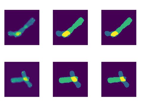 Segnet—chromosome Separating Overlapping Chromosomes With Segnet
