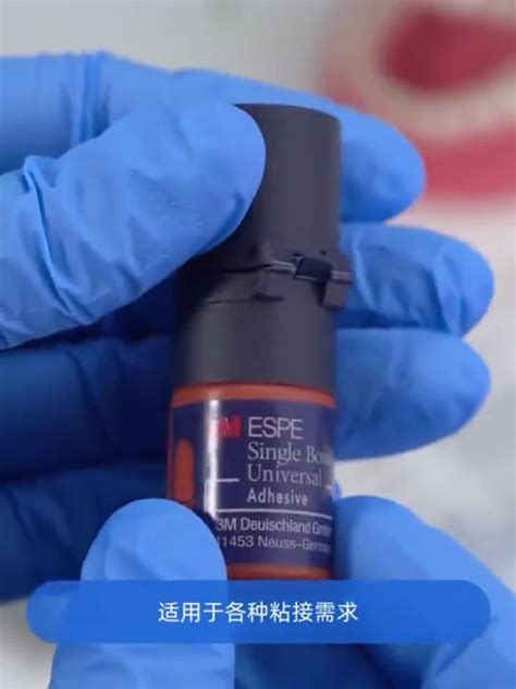 3m 8th Generation Light Cure Composite Resin Bonding Agent Dental Bonding Agent Universal