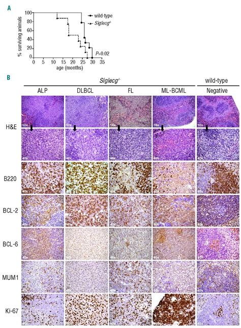 Siglec G Deficiency Increases Susceptibility To Develop B Cell Lymphoproliferative Disorders