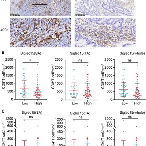 Relationship Between Siglec15 Expression And The Infiltration Of Download Scientific Diagram