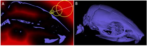sphere casting a shown is a sagittal slice through a segmentation of