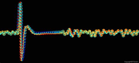 Tmseeg Download Eeg Signal Processing