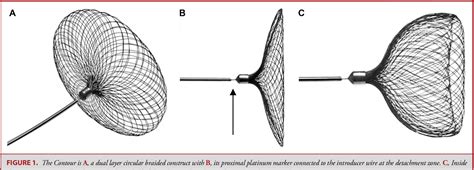 The Safety And Effectiveness Of The Contour Neurovascular System Contour For The Treatment Of