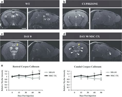 Mri And In Vivo Myelin Content Quantification Representative Brain