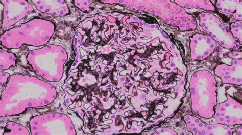 Digital Microscopes Microscope Products Nikon Instruments Inc