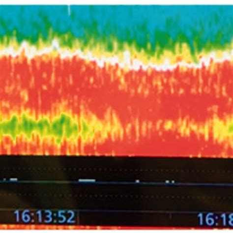 Representative Image Of A Spectrogram Showing The Density Spectral