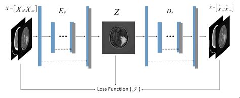 Figure 1 From Multimodal Glioma Image Segmentation Using Dual Encoder