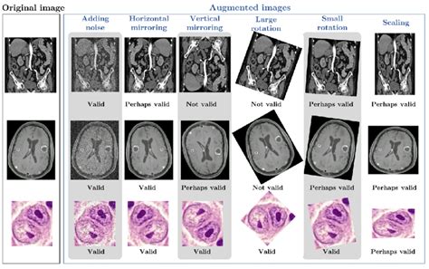 Examples Of Augmentations Applied To Sample Images The Download Scientific Diagram