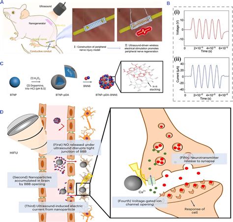 Us‐driven Piezoelectric Effect A Us Driving Strategy Of The
