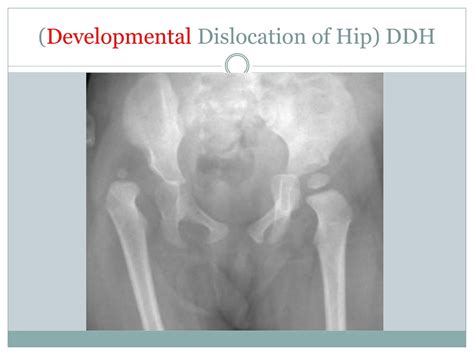 Ppt Introduction To Orthopaedics Powerpoint Presentation Free
