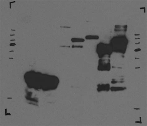 Multiple Ciliary Localization Signals Control Inpp5e Ciliary Targeting Elife