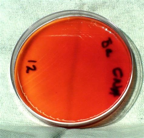 Free Picture Anthrax Bacteria Pathogen