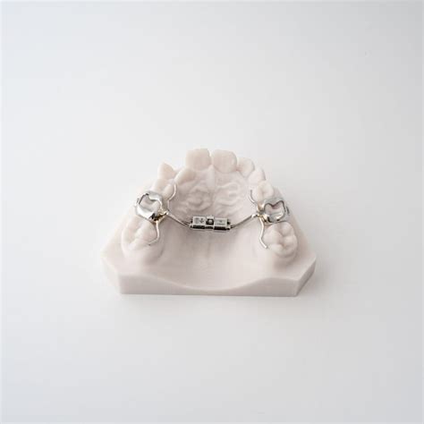 Compact Rpe Rapid Palatal Expander Odl Orthodontic Labs