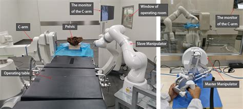 A Teleoperated Robotic System Assisted Percutaneous Transiliac