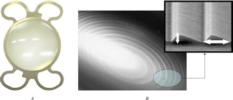 Figure 5 From Design And Qualification Of A Diffractive Trifocal