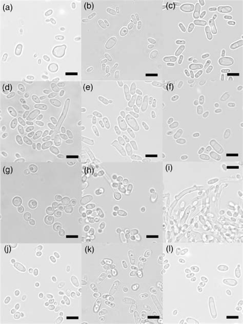 Budding Yeast Cells Pseudohyphae And Septate Hyphae Of The Novel