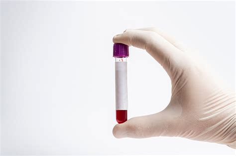 Mengenal Basofil Dan Perannya Dalam Sistem Imun Tubuh