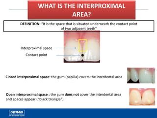 Importance Of Interproximal Hygiene Pptx