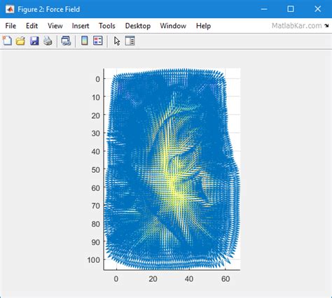 سیستم بیومتریک گوش سه مرحله ای با تکنیک های پردازش تصویر در متلب متلب کار