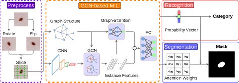 Figure 1 From Melanoma Recognition And Lesion Segmentation Using Multi Instance Learning