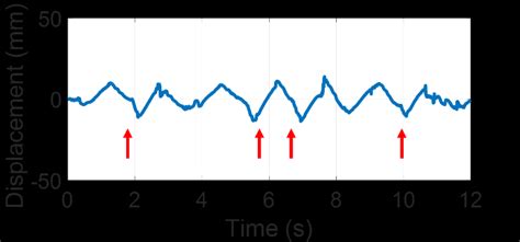 Displacement Due Incorrect Breathing And Eyes Blinking During It Is Download Scientific