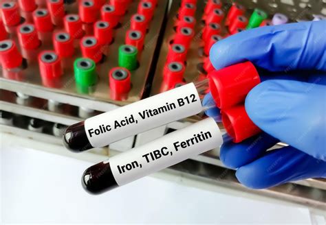 Premium Photo Iron Tibc Ferritin And Folic Acid Vitamin B12 Test To