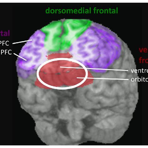 Schematic View Of Major Divisions Of The Frontal Lobes Pfc Prefrontal Download Scientific