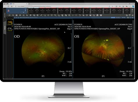 Ophthalmology Infinitt