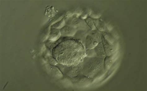 Figure Hatching Blastocyst Grade Showing A Large ICM At The Base Of The Blastocyst