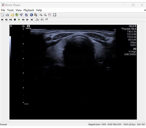 Synchronous Triplanar Reconstruction Integrated With Color Doppler