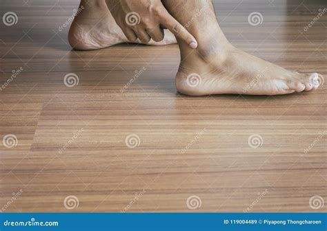 Dry Circle Patch On Ankle At Elaine Hudson Blog