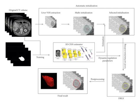 The Proposed Liver Tumor Segmentation Framework That Consists Of Four