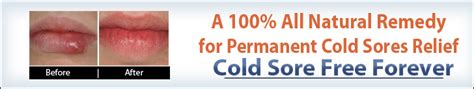 Cold Sore Causes Symptoms And Prevention Of Outbreak