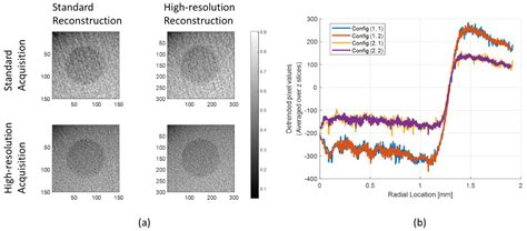 Cone Beam Reconstruction Distortion The Best Picture Of Beam