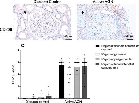 Cd206 Cd68 Mono Macrophages And Serum Soluble Cd206 Level Are Increased In Antineutrophil