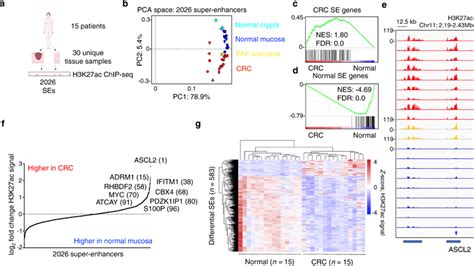 Scientists Discover Super Enhancer” Gene Linked To Colorectal Cancer