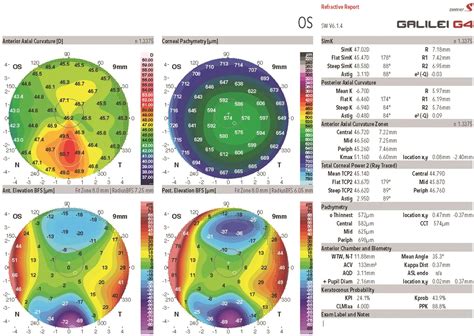 Dual Scheimpflug Imaging American Academy Of Ophthalmology