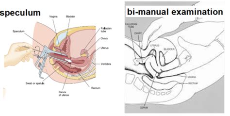 WM420 Reproductive System Flashcards Quizlet