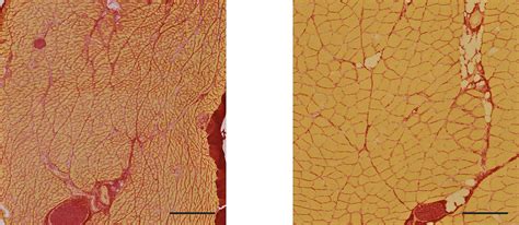 Picture Of The Month Microstructure Of Skeletal Muscle The Key To Understanding Our Bodys