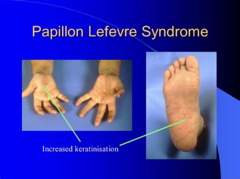 Periodontal Diseases Role Of Systemic Factors Flashcards Quizlet