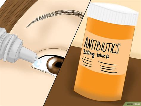 Cách để Trị nhiễm Khuẩn Pseudomonas wikiHow