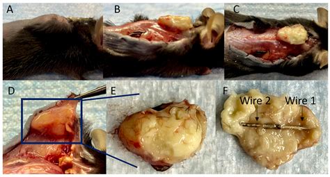 A Unique Mouse Model For Quantitative Assessment Of Biofilm Formation On Surgical Implants In