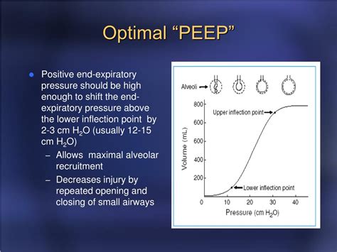 Ppt Ards Powerpoint Presentation Free Download Id 3928837