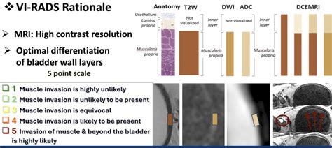 Eau 2024 No Need For Turbt Vi Rads Makes The Diagnosis
