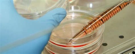 Troubles de l érection une greffe de cellules souches dans le pénis pour retrouver la forme