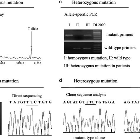 Heterozygous Mutation Of Jak2v617f Detected By Massarray Assay Was Download Scientific Diagram