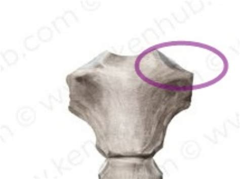 Acidente Ósseos JÚlio CÉsar De Meira Quizur