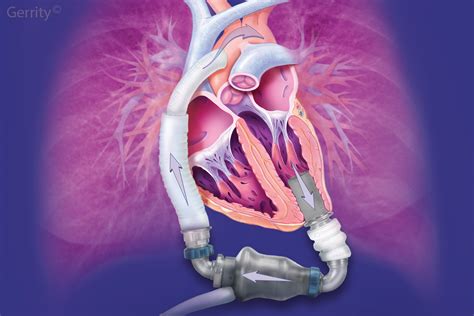 Illustration — Chicago Medical Graphics