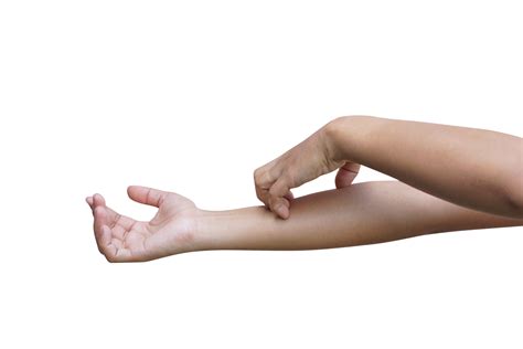 Human Itching On The Arm 20943650 Png
