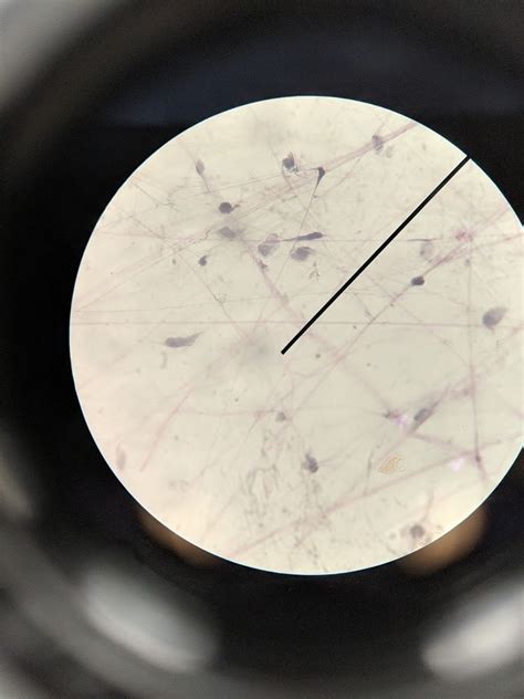 Adipose Connective Tissue Diagram Quizlet